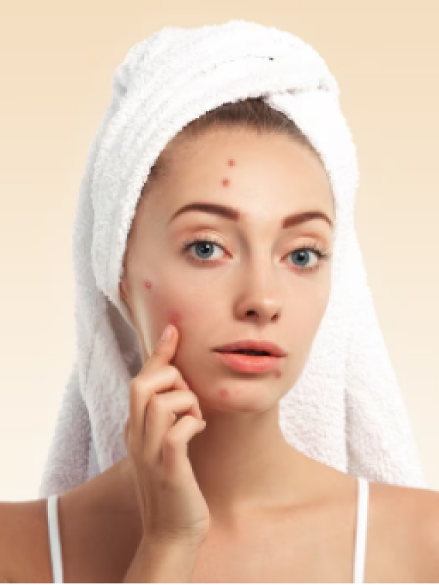 Pimple Causes: चेहरे पर मुंहासो के पीछे छुपा हैं ये राज! जानिए 5 जगहों ...